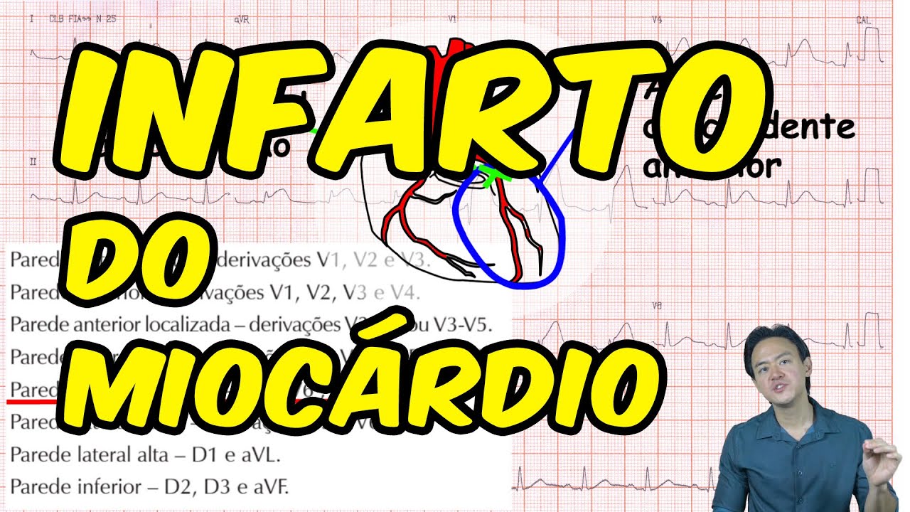 Entenda como avaliar um ECG em caso de infarto do miocárdio