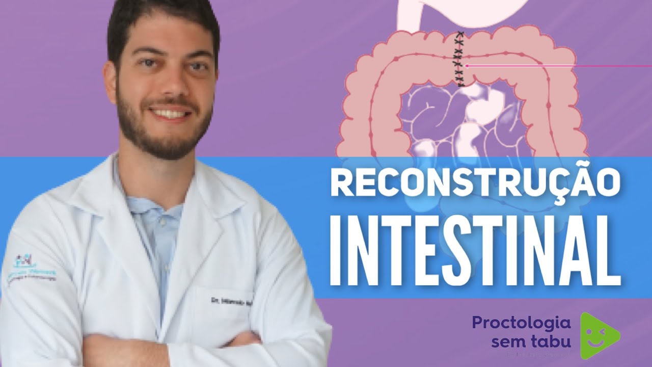 Reconstrução Intestinal: Como funciona e o que esperar do procedimento.