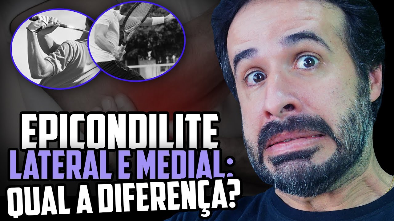 Saiba as diferenças entre epicondilite lateral e medial.