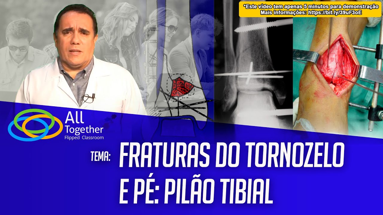 Pilao Tibial